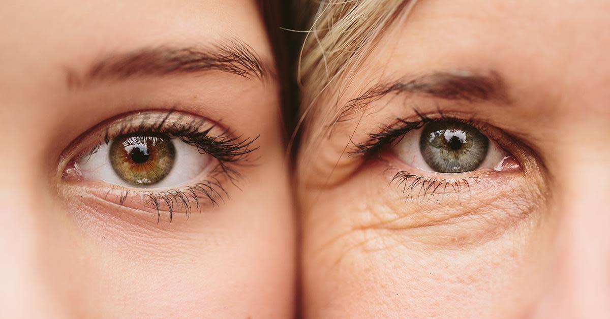 What Are The Symptoms Of Dry Eyes MyHealth1st