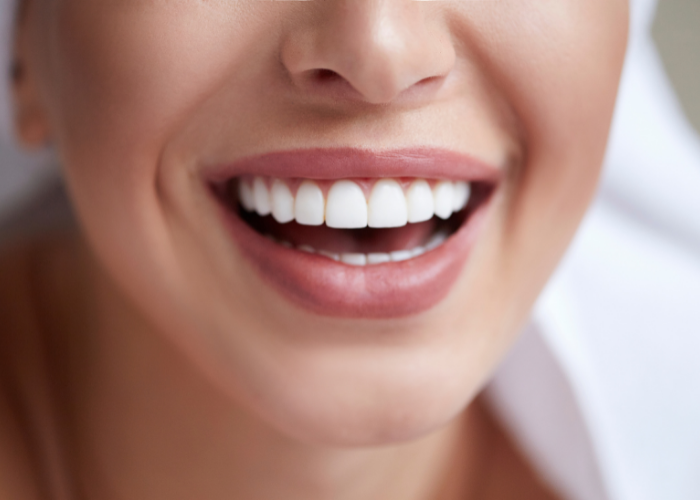 The Secret Benefits of Straight Teeth | MyHealth1st
